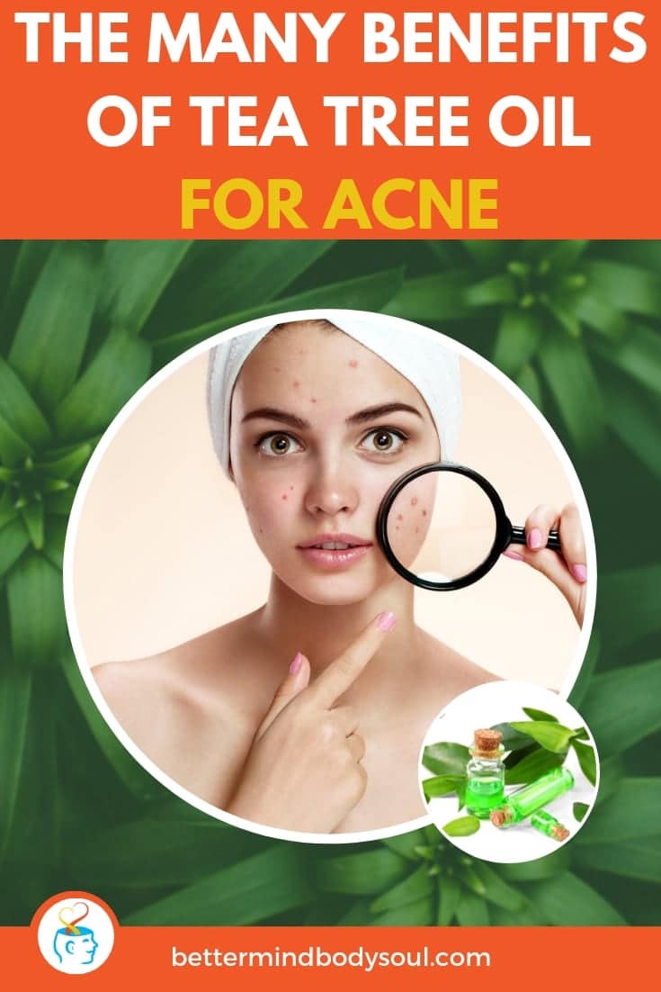 Tea Tree Oil Benefits For Acne That You Need To Know