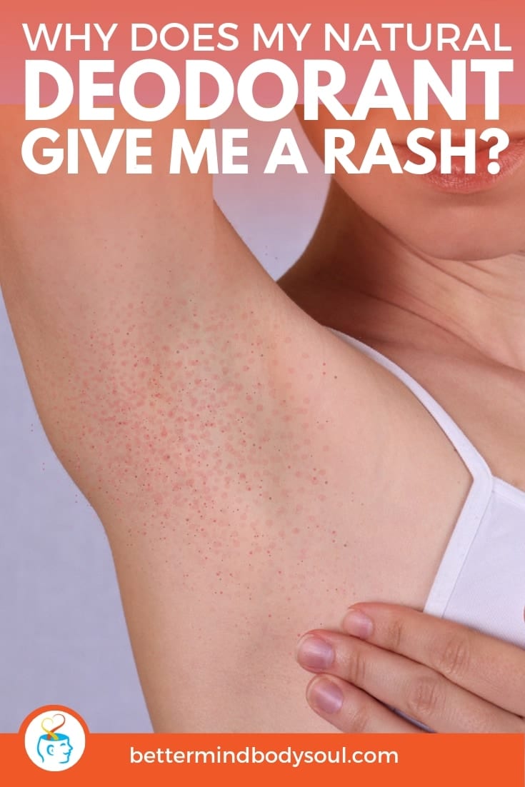 Why Does Natural Deodorant Give Me A Rash 